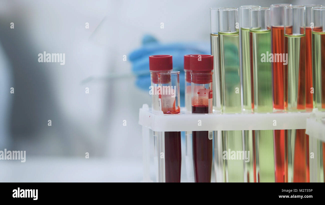Blood samples standing on the table, HIV test, microbiological ...