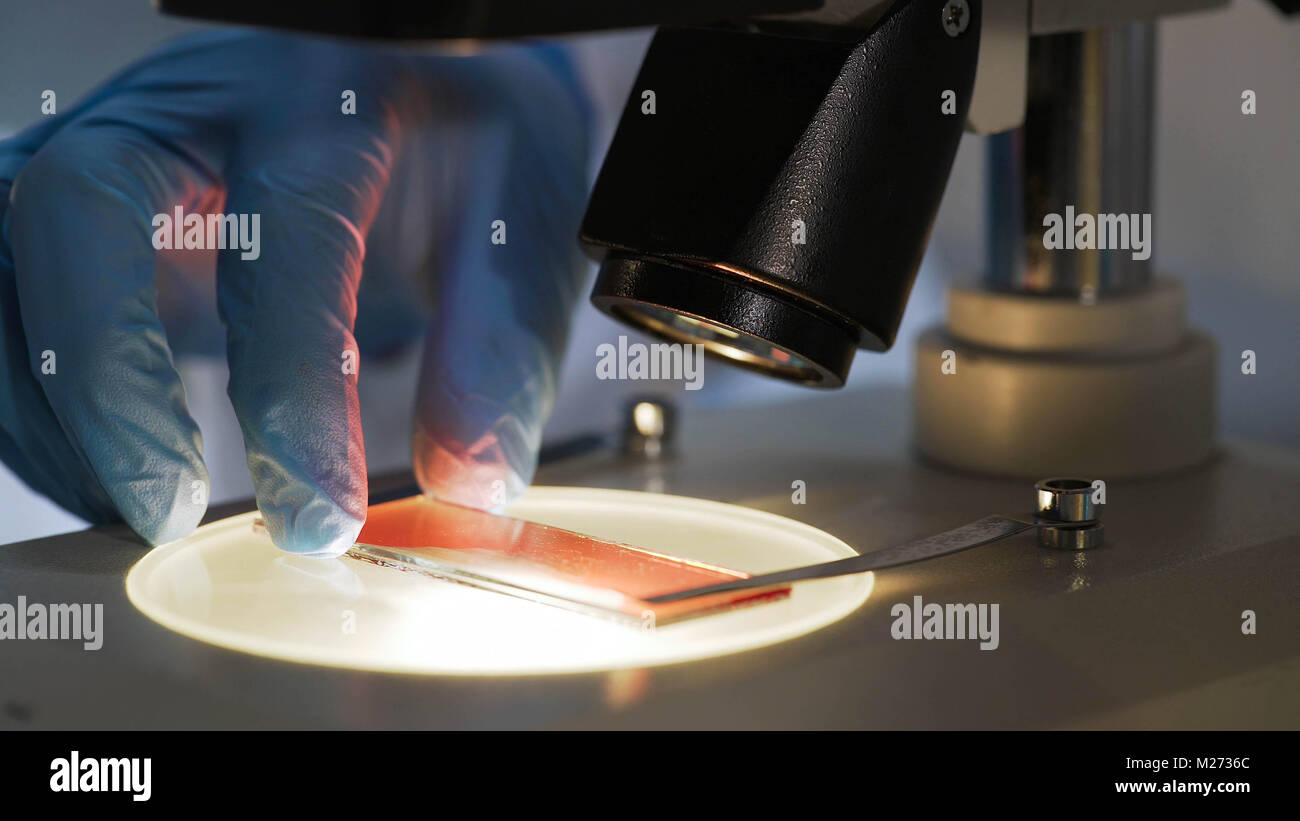 Medical scientist studying blood sample under microscope, biochemical ...