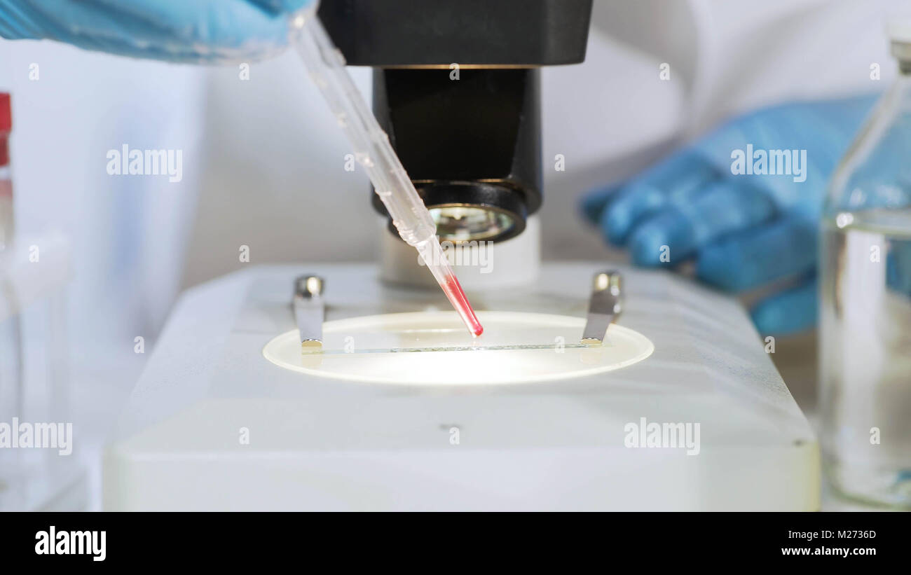 Biochemist preparing slide with blood sample, examines it under ...