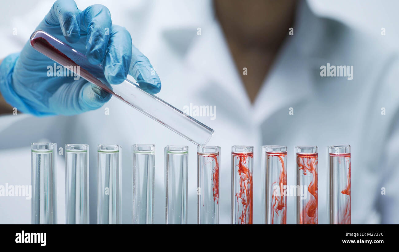 Amino acid test hi-res stock photography and images - Alamy