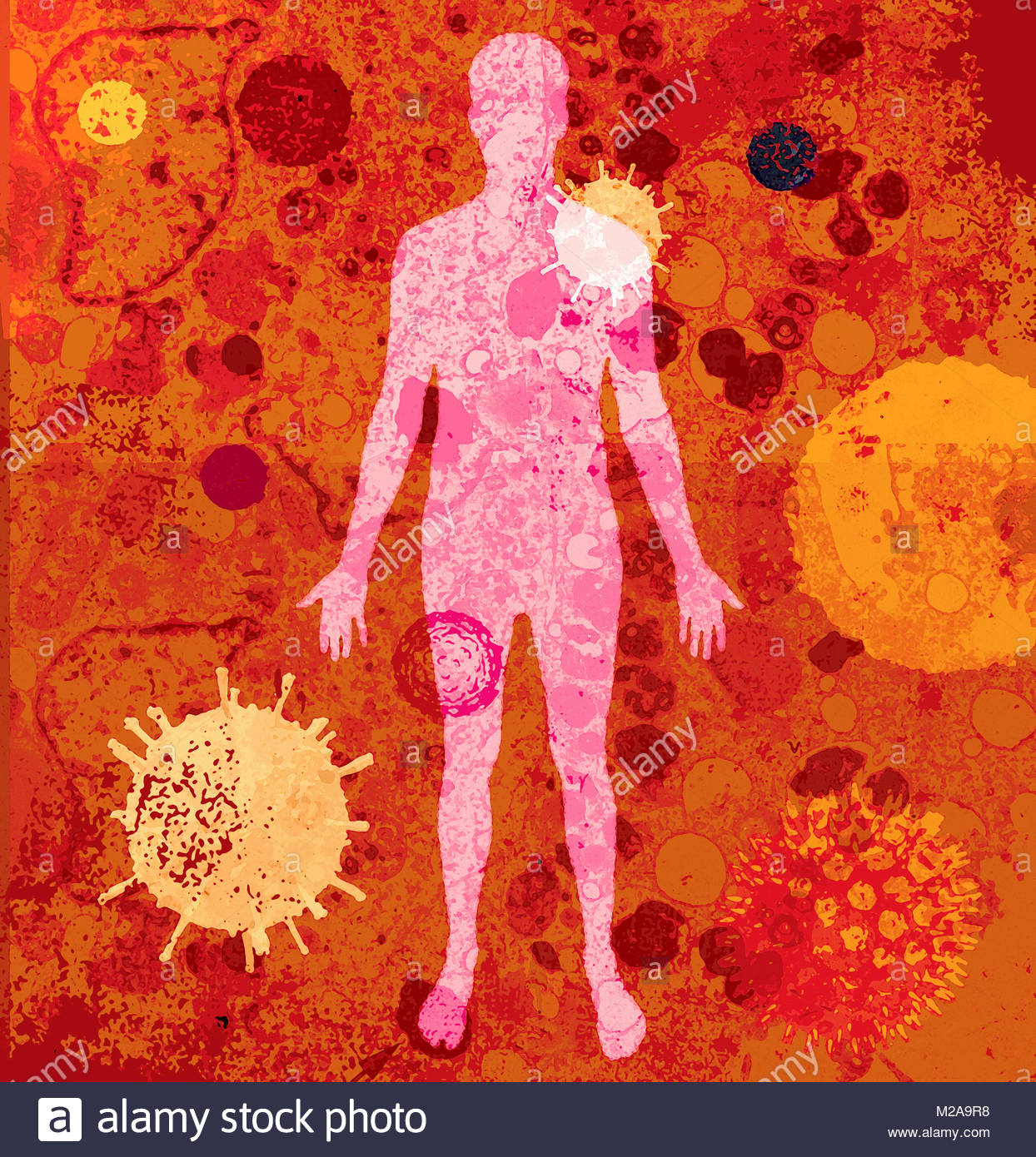 Different Viruses Stock Photos & Different Viruses Stock Images - Alamy