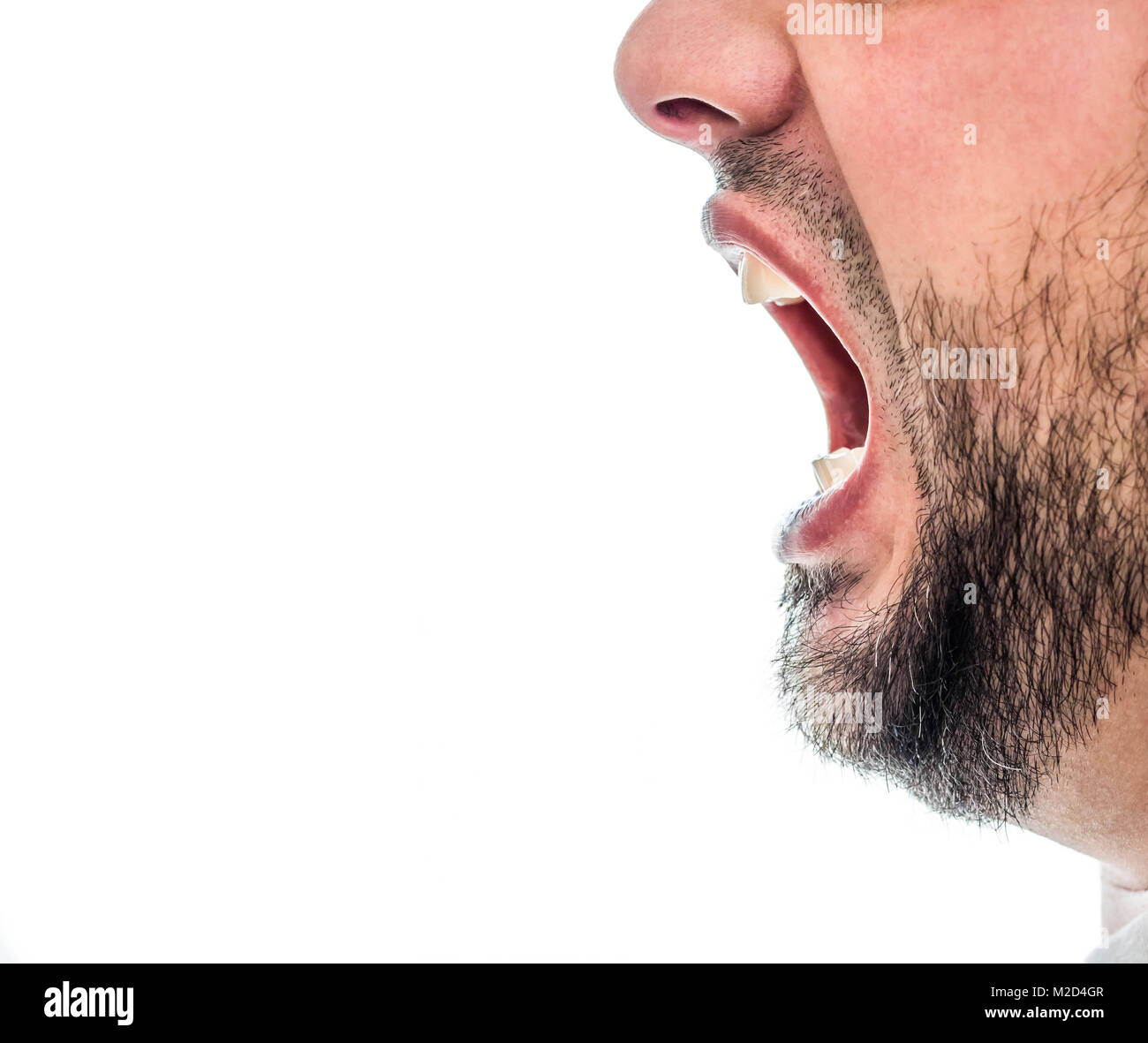 A mans face is seen in the image with his mouth wide open. He is ...