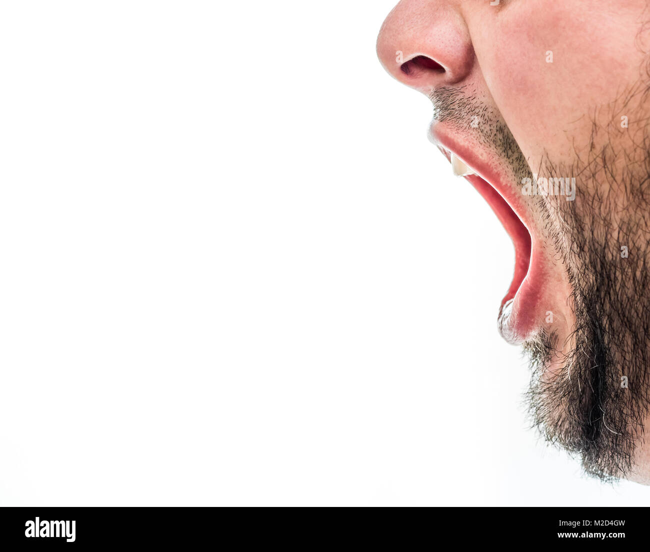 A mans face is seen in the image with his mouth wide open. He is ...