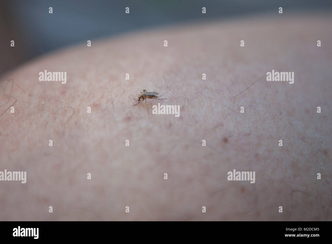 mosquito on the skin Stock Photo - Alamy