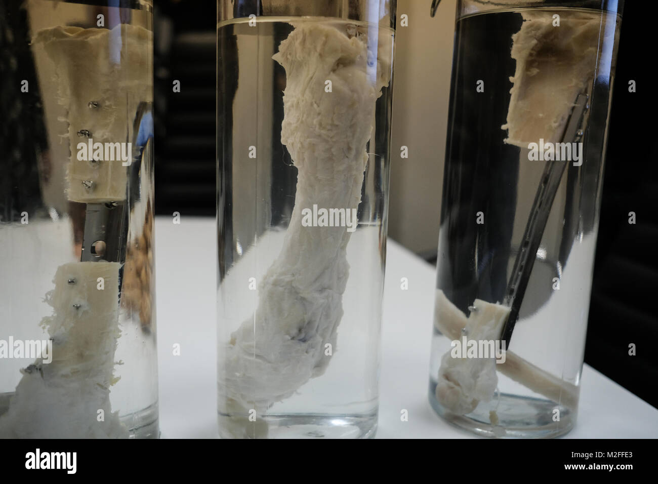 Human tissue sample hi-res stock photography and images - Alamy