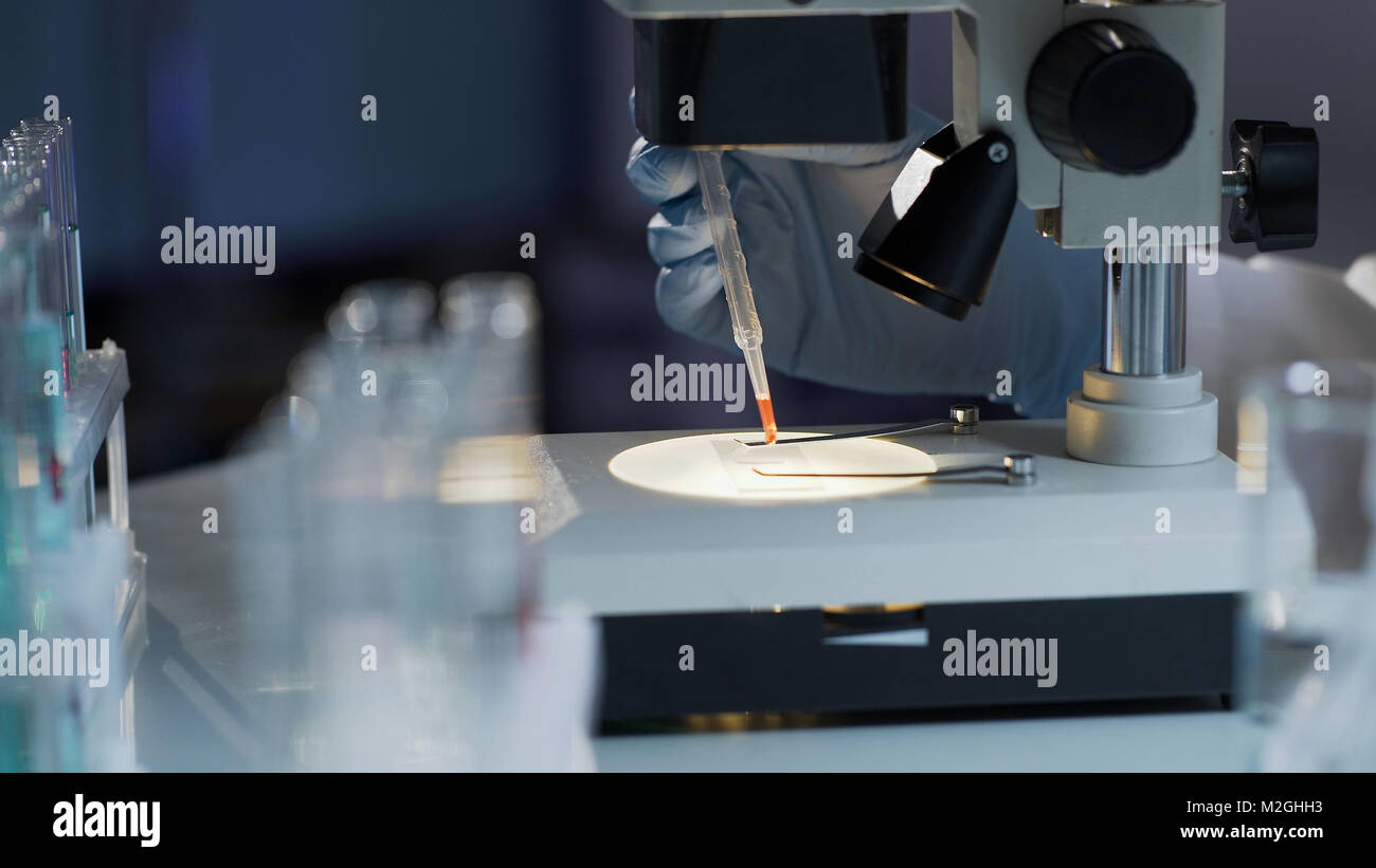 Hiv antibodies test hi-res stock photography and images - Alamy