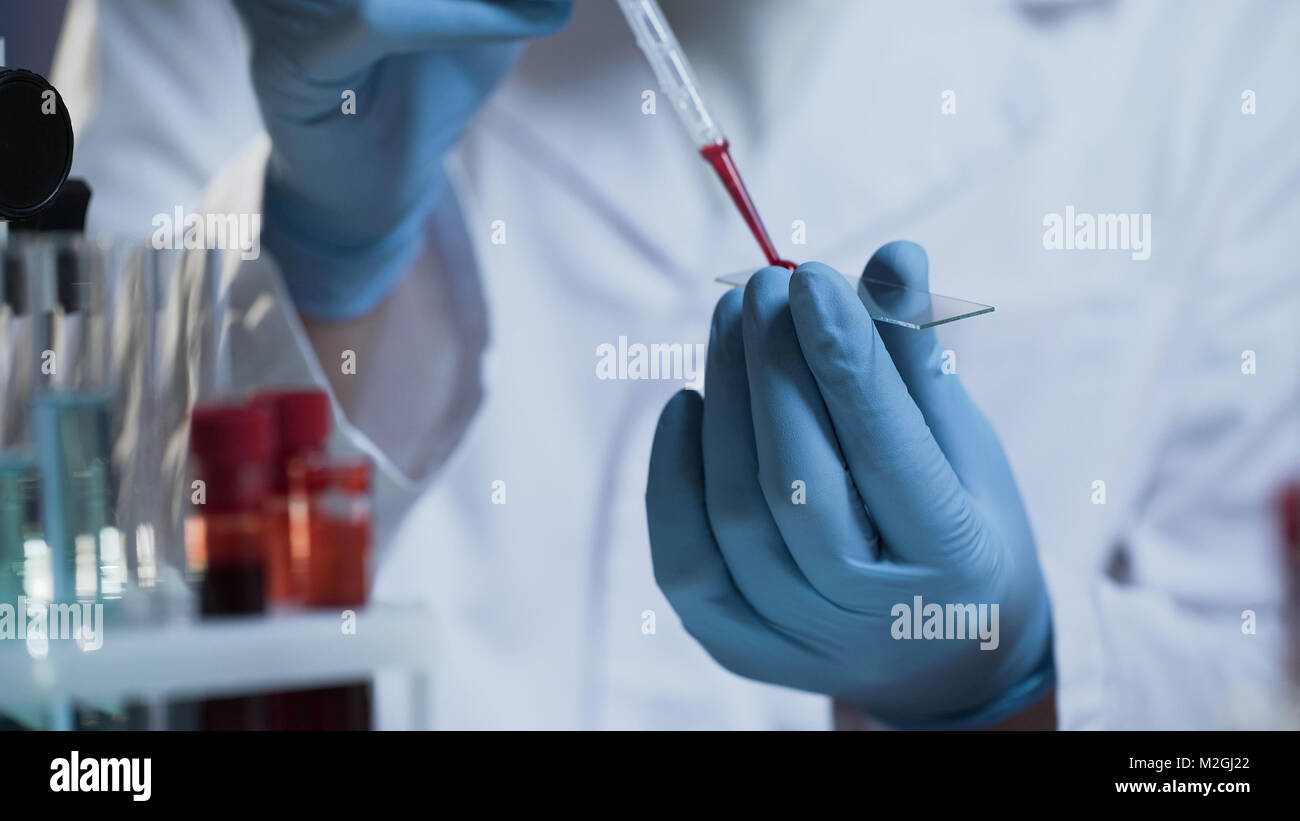 Laboratory worker preparing slide with blood samples, creating new ...
