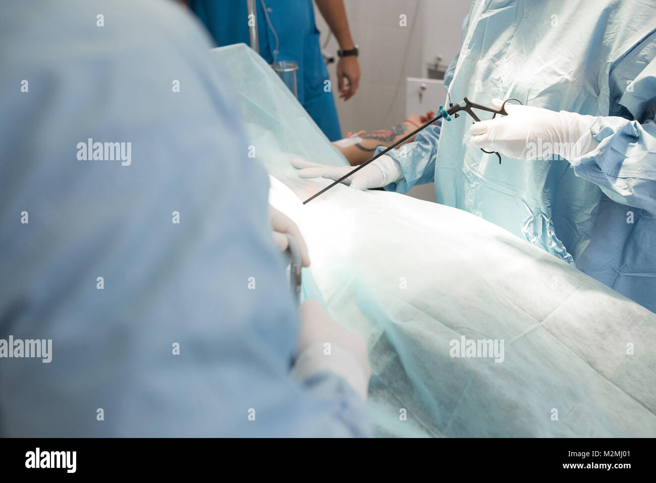 Laparoscopic surgery hi-res stock photography and images - Alamy