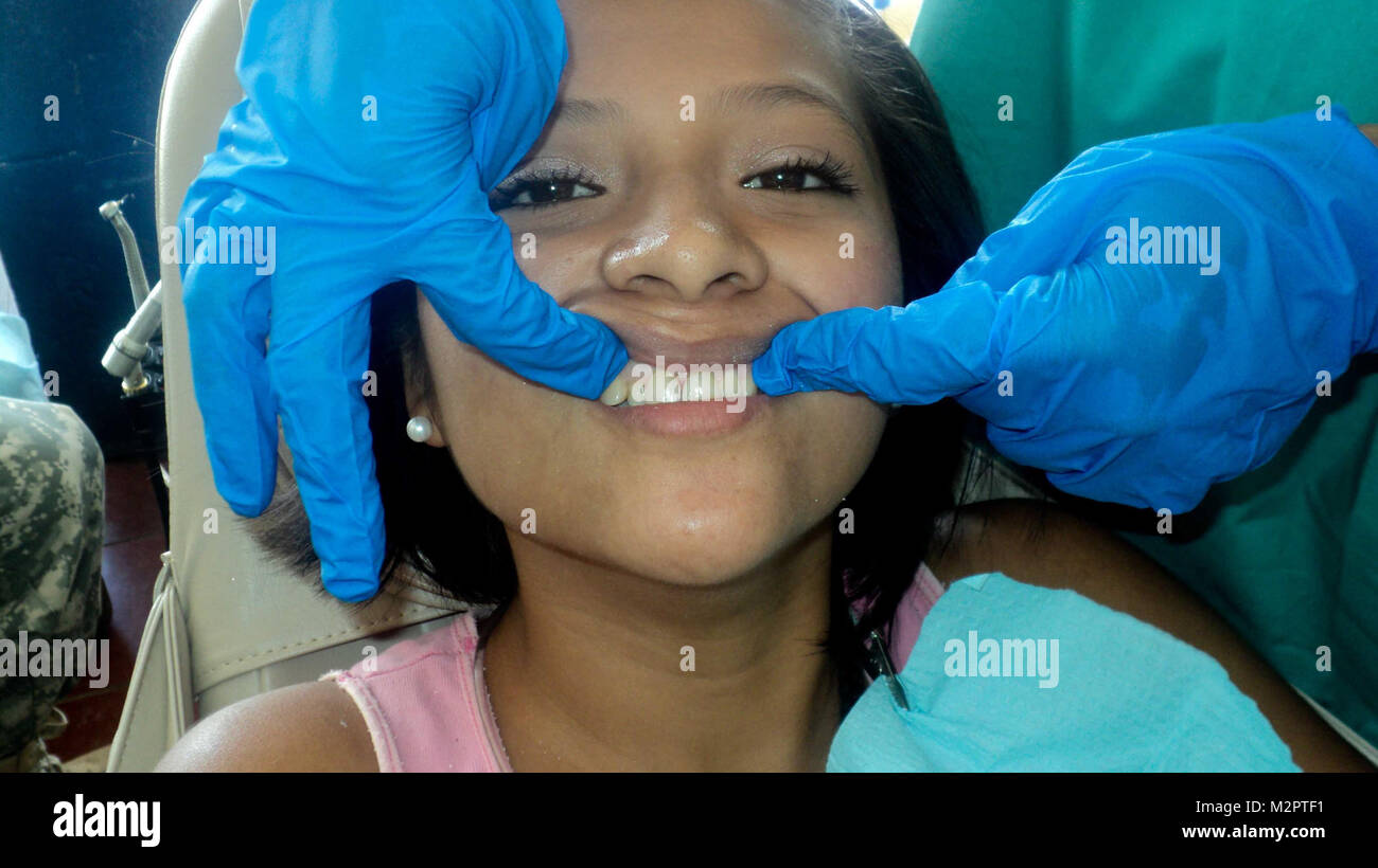 A patient shows her teeth after treatment for "bottle rot," which had ...