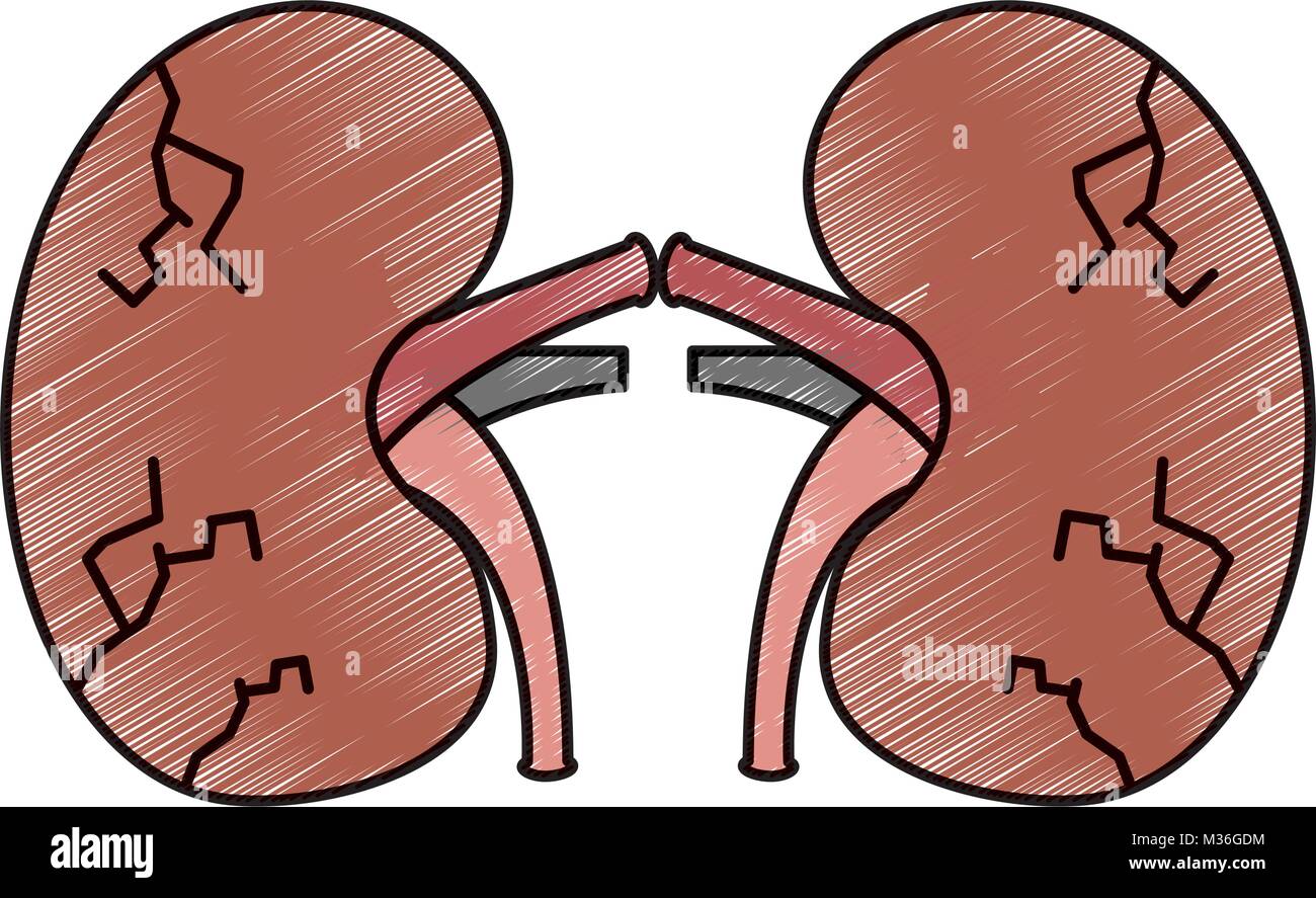 Unhealthy Human Kidney