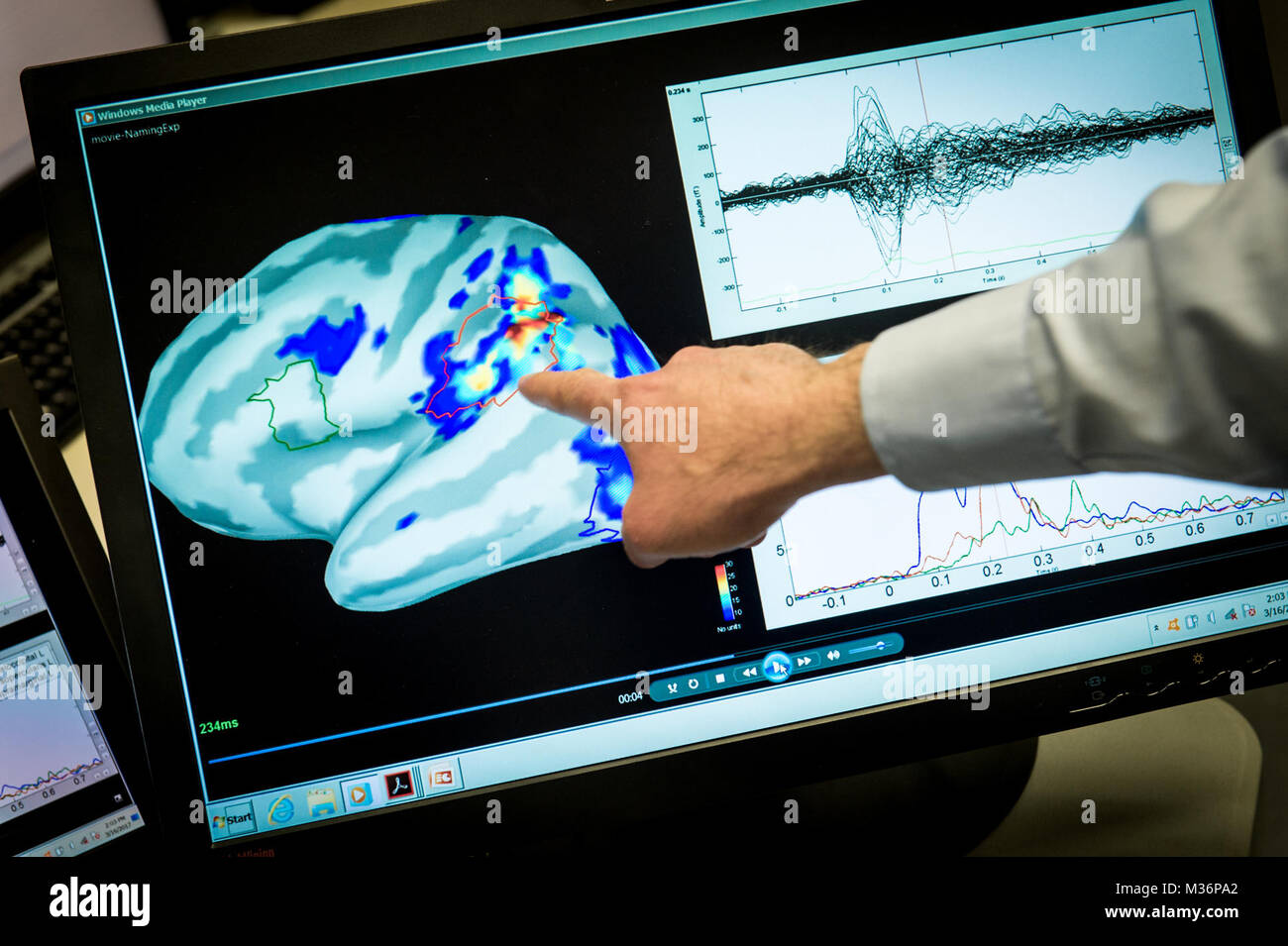 Magnetoencephalography brain hi-res stock photography and images - Alamy