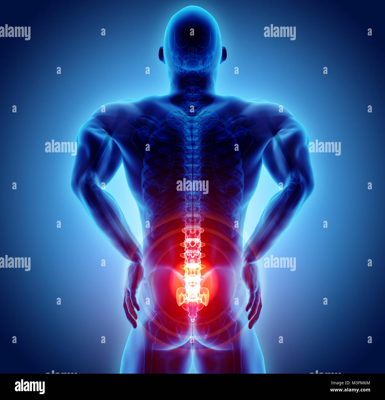 3D Illustration of sacral spine painful, medical concept Stock Photo ...