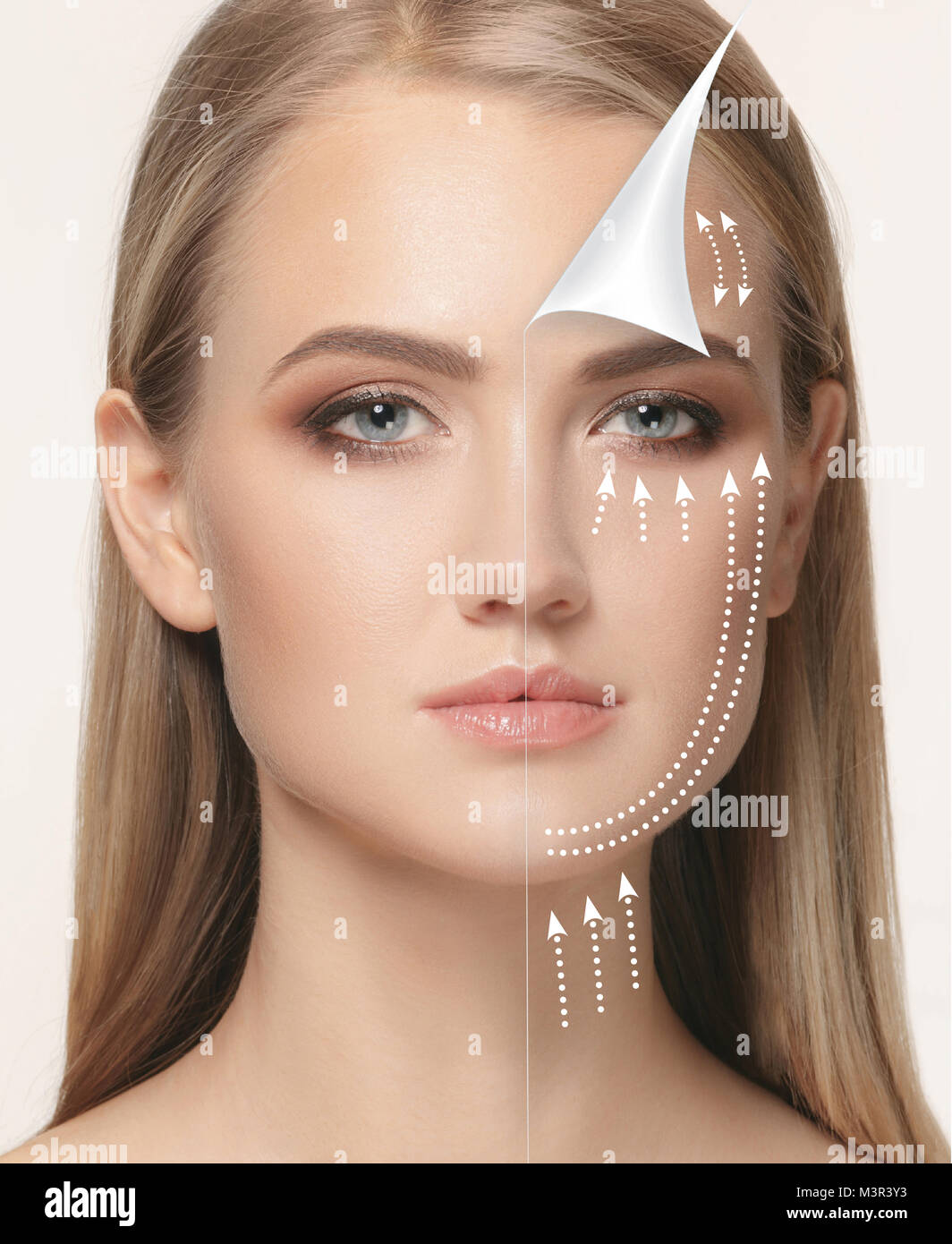 The young female face. Antiaging and thread lifting concept Stock Photo ...