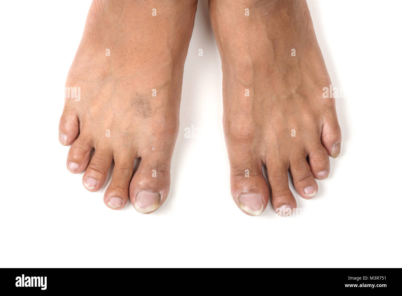 foot, toe and toenail of the man on white background Stock Photo - Alamy