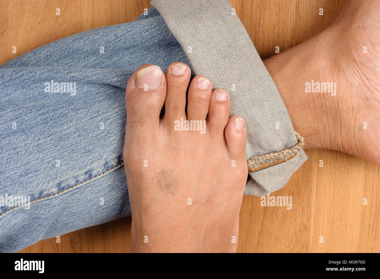 foot, toe and toenail of the man Stock Photo - Alamy