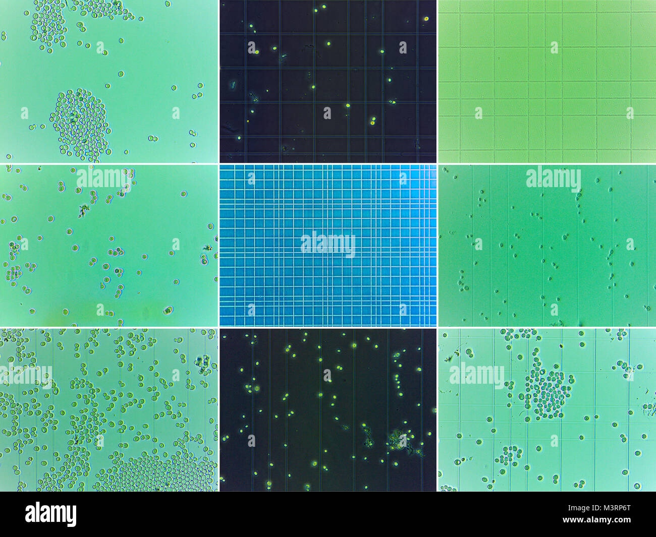Haemocytometer hi-res stock photography and images - Alamy