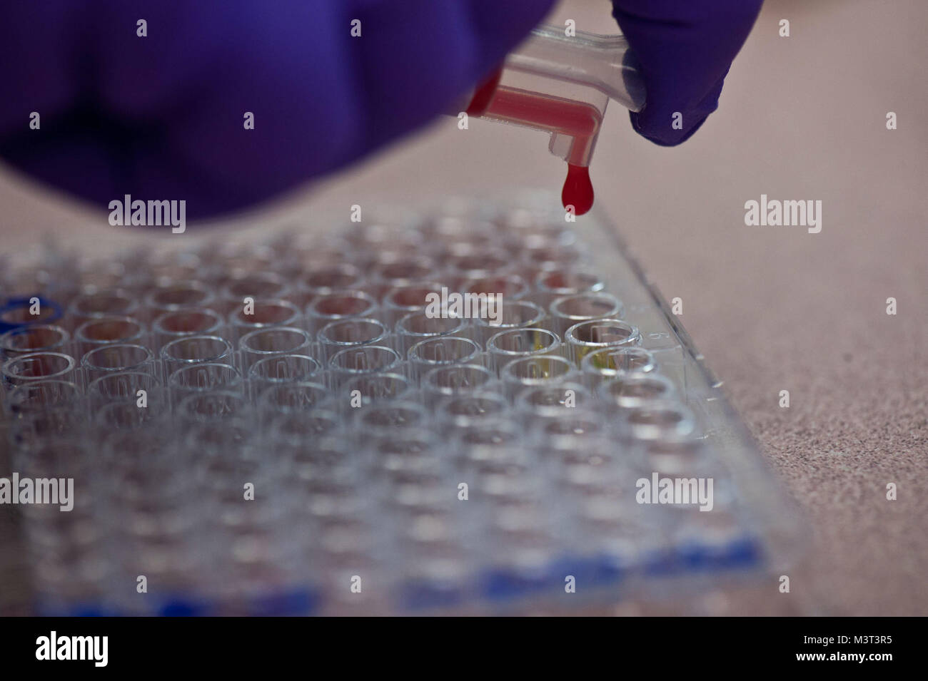 A blood laboratory technician loads a blood and saline mix into a ...