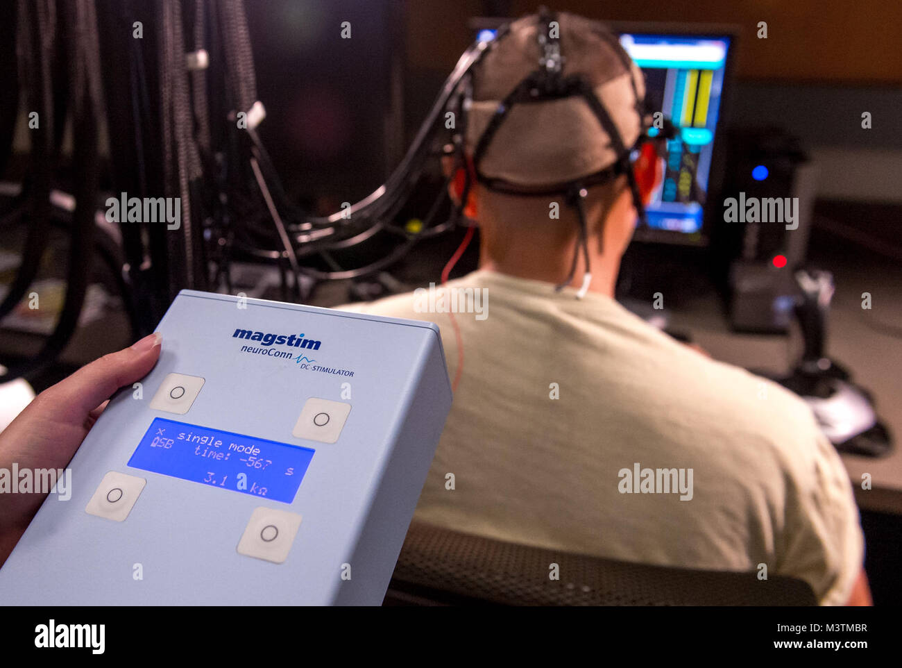 Electrodes administer transcranial direct current stimulation (tDCS ...