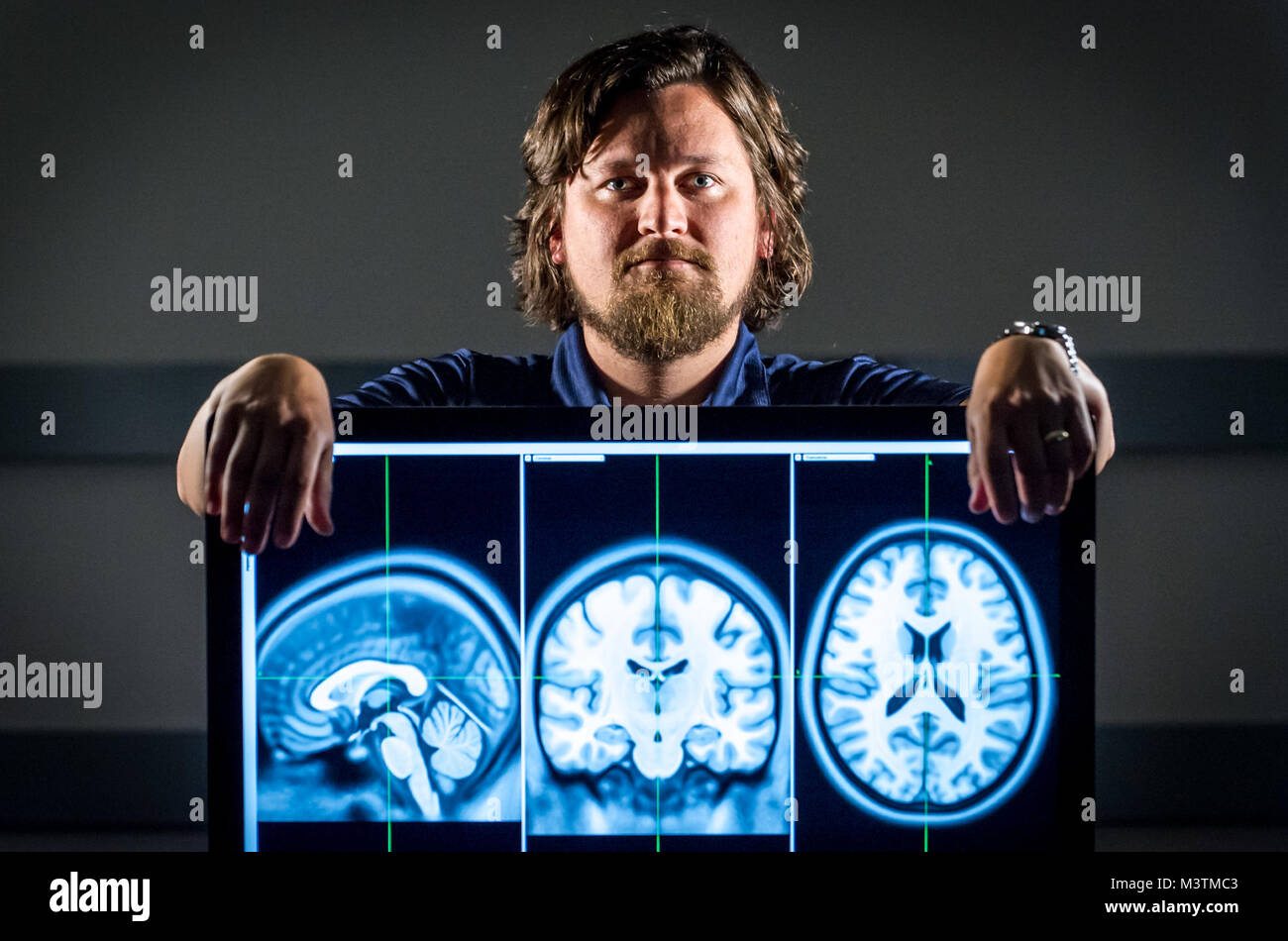 Human brain areas hi-res stock photography and images - Alamy