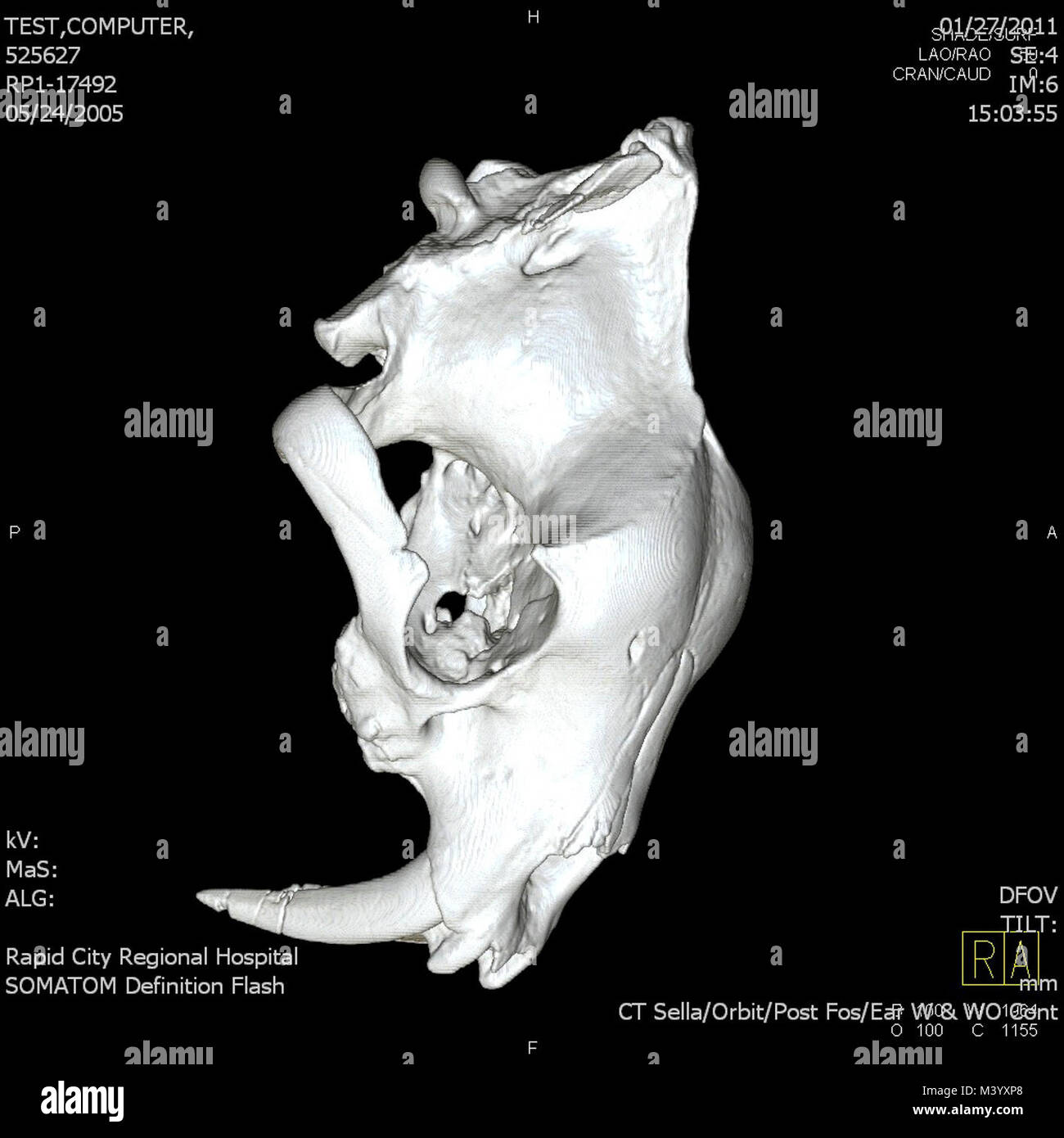 . CT Scan Image of fossil skull Stock Photo - Alamy