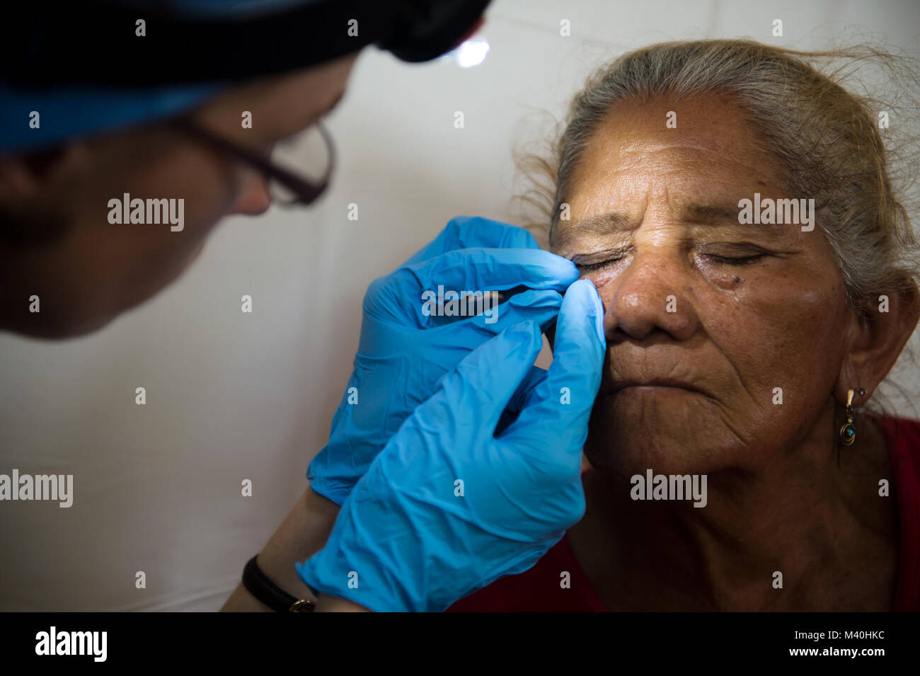 Dermatologist examines a patient hi-res stock photography and images ...