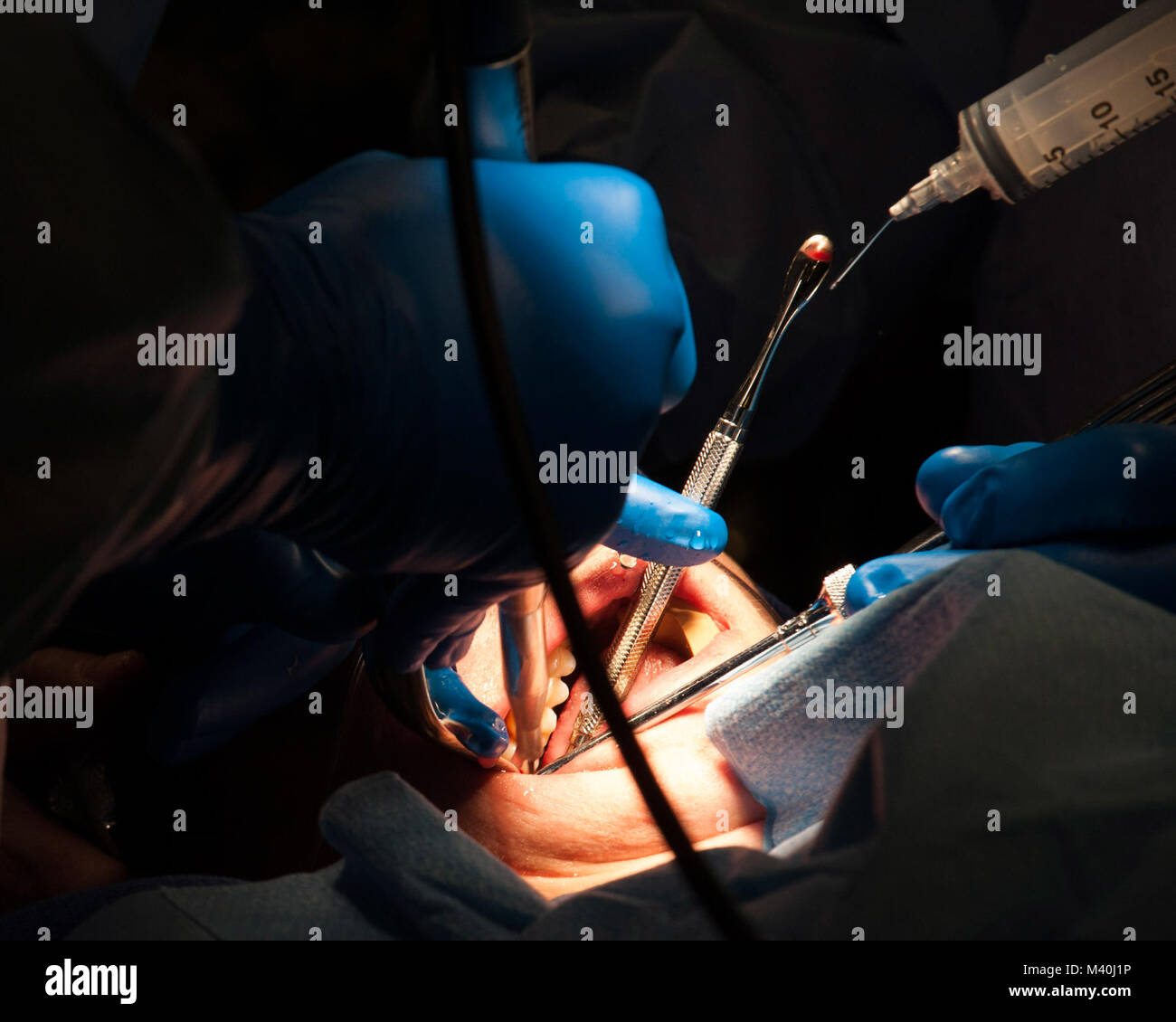 A patient receives oral surgery during a 212th Combat Support Hospital ...