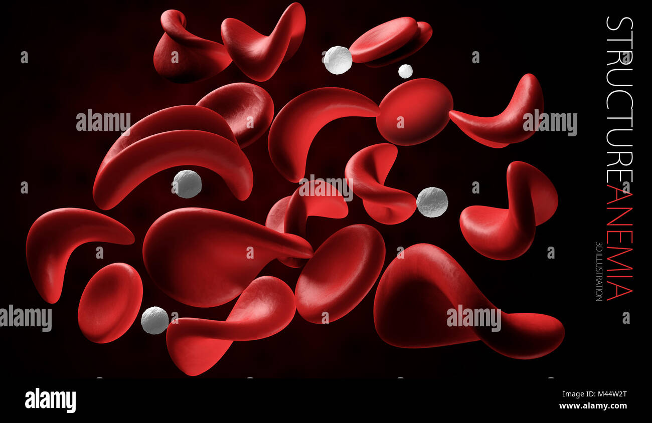 Sickle cell hi-res stock photography and images - Alamy Sickle cell hi-res stock photography and images - Alamy