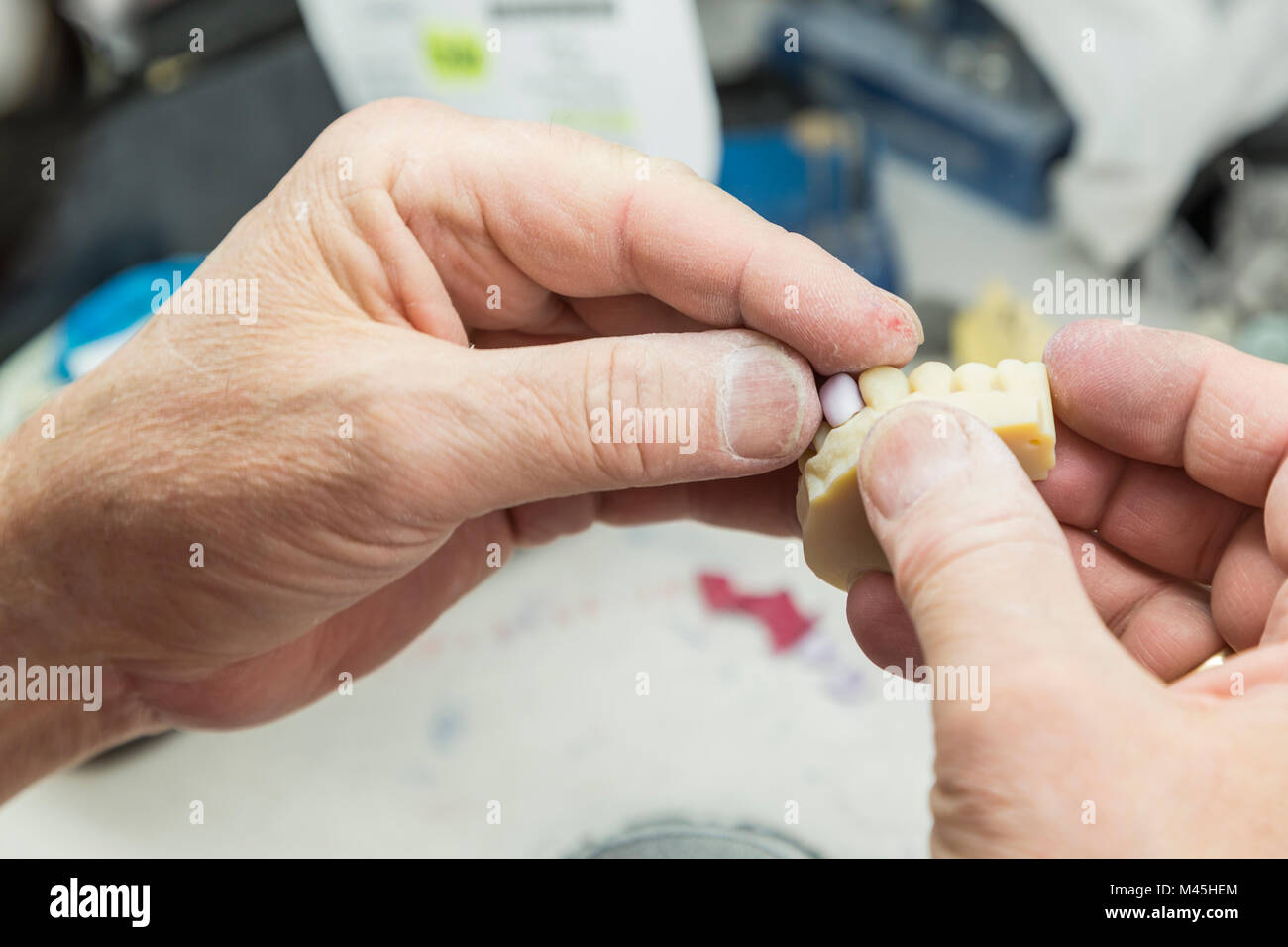 Male Dental Technician Working On A 3D Printed Mold For Tooth Implants ...