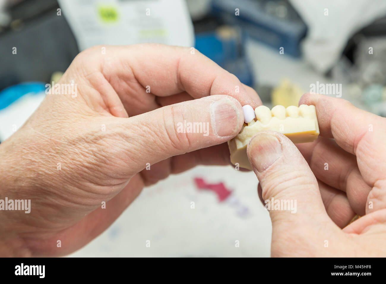 Male Dental Technician Working On A 3D Printed Mold For Tooth Implants ...