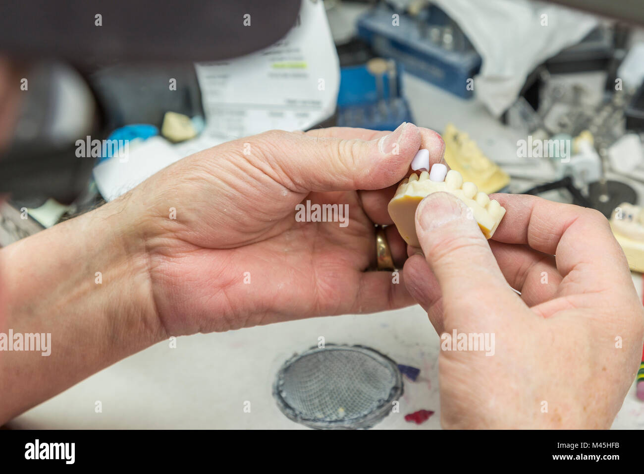 Male Dental Technician Working On A 3D Printed Mold For Tooth Implants ...