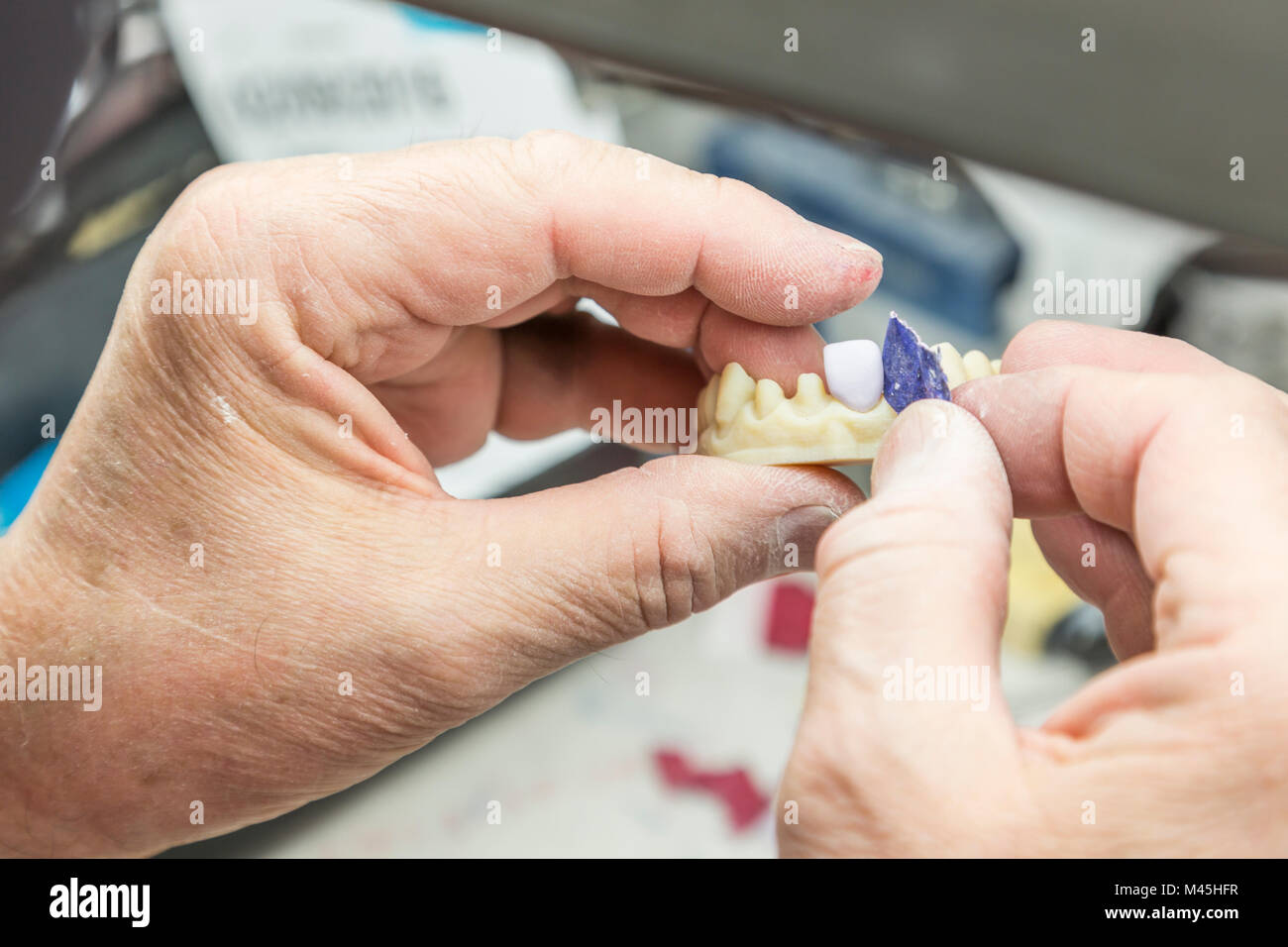 Male Dental Technician Working On A 3D Printed Mold For Tooth Implants ...