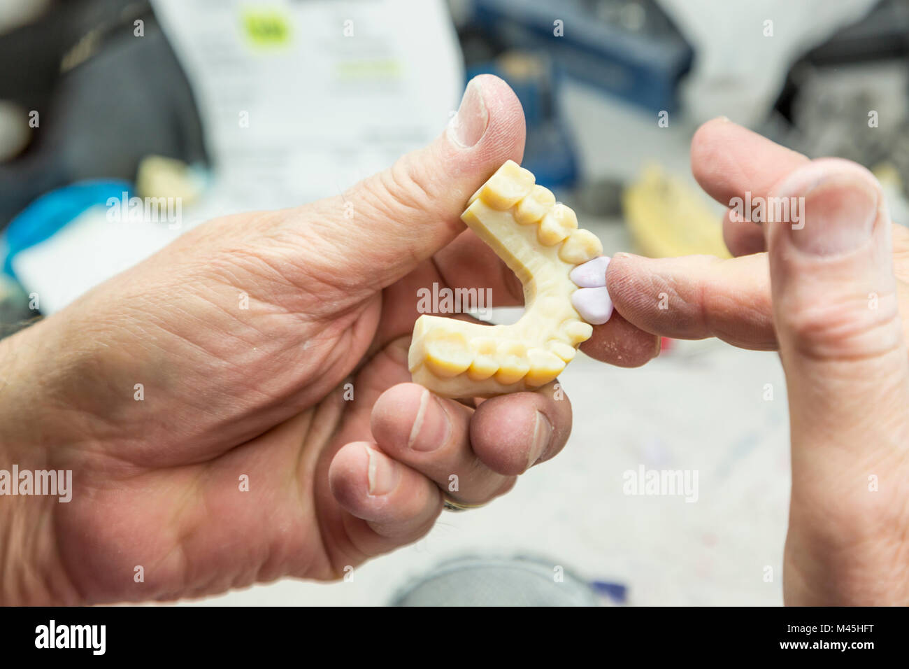 Male Dental Technician Working On A 3D Printed Mold For Tooth Implants ...