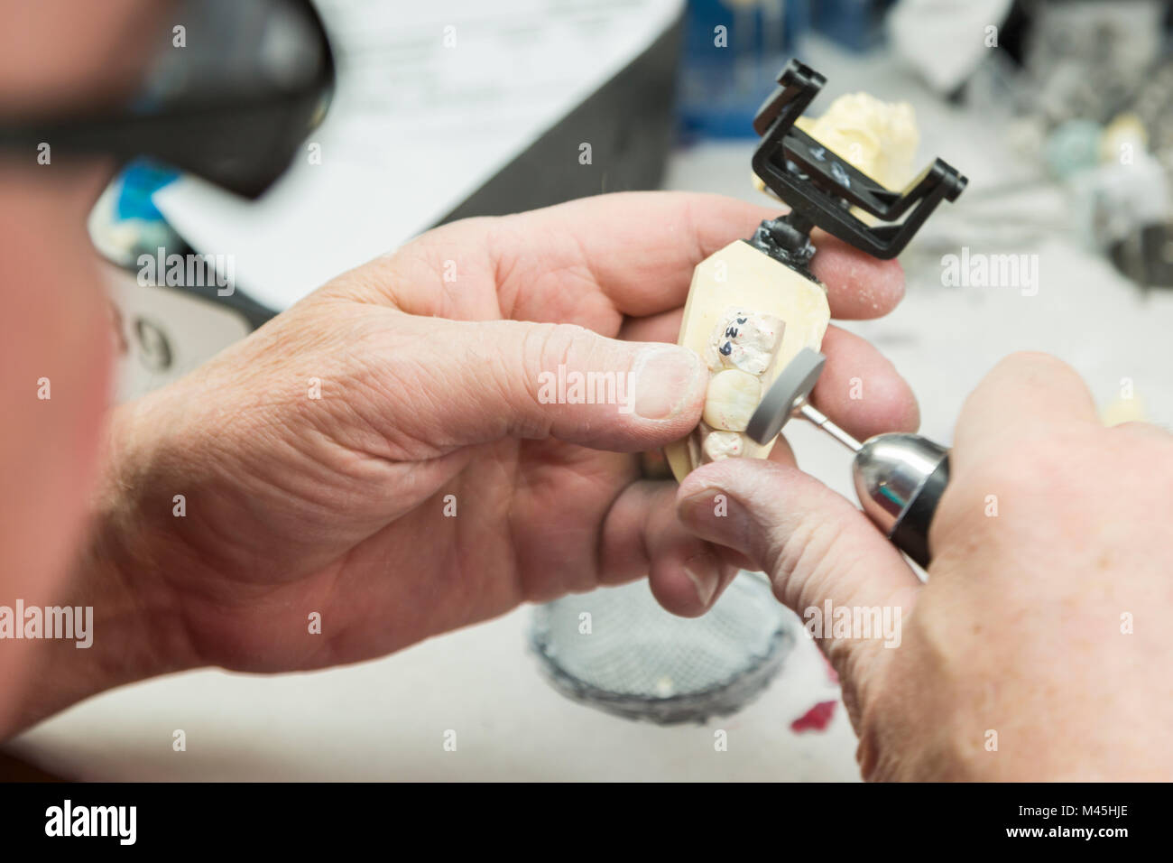 Male Dental Technician Working On A 3D Printed Mold For Tooth Implants ...