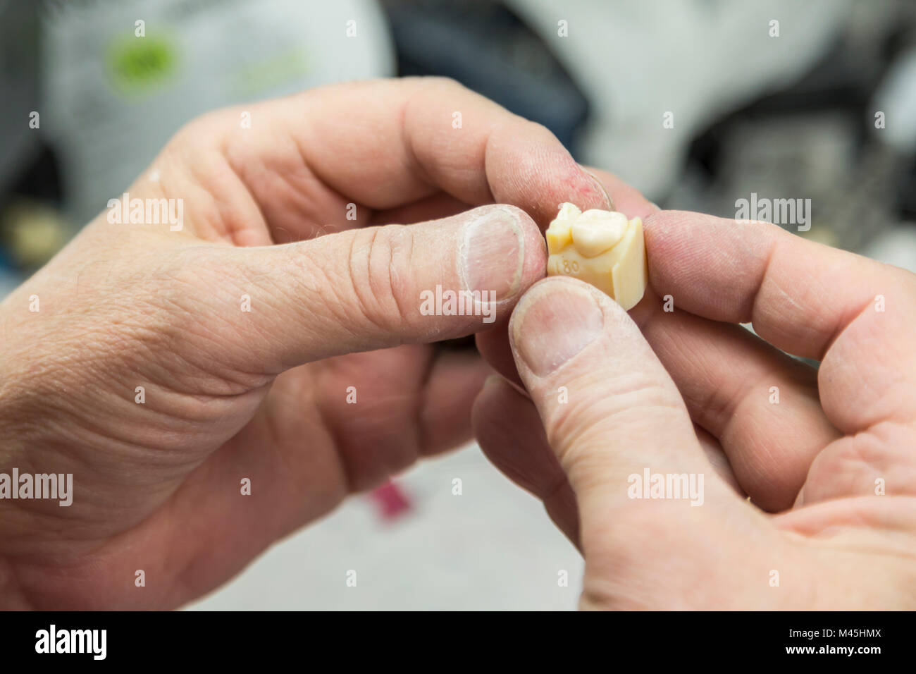 Male Dental Technician Working On A 3D Printed Mold For Tooth Implants ...