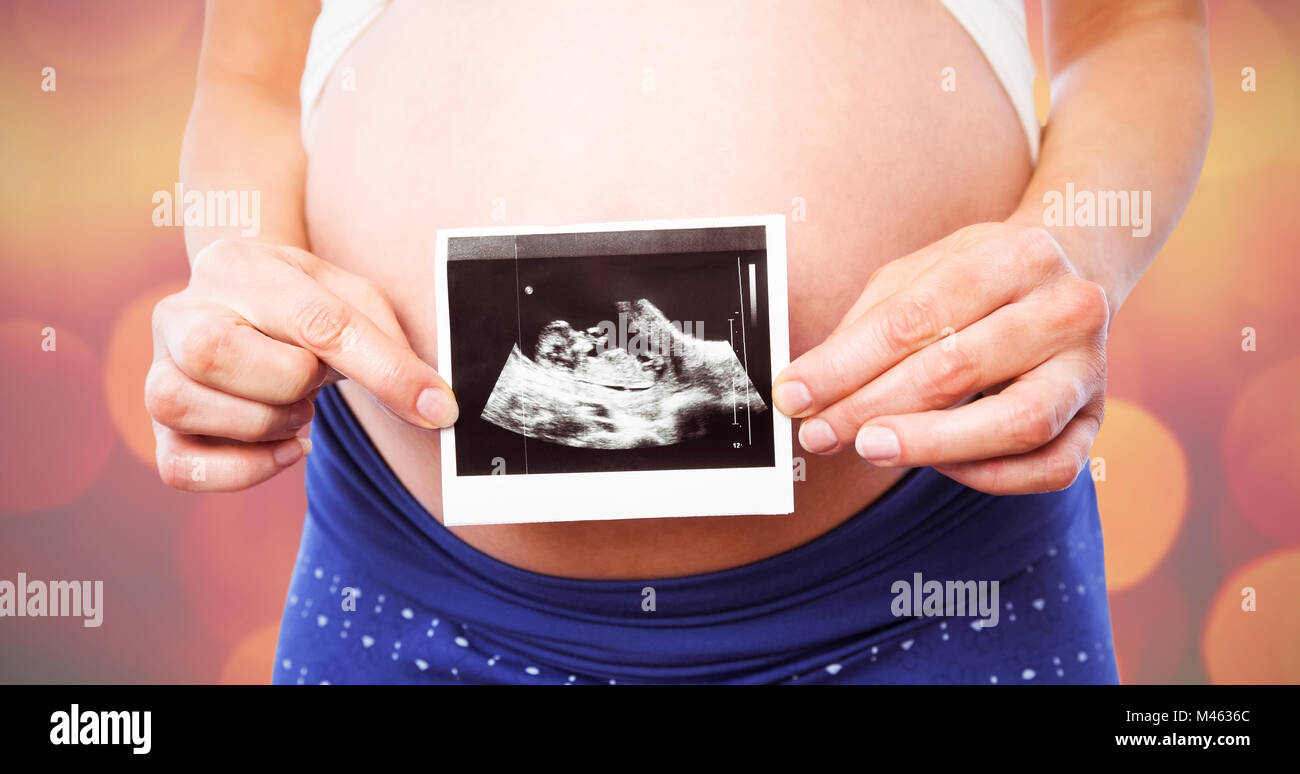 Composite image of pregnant woman showing ultrasound scans Stock Photo ...