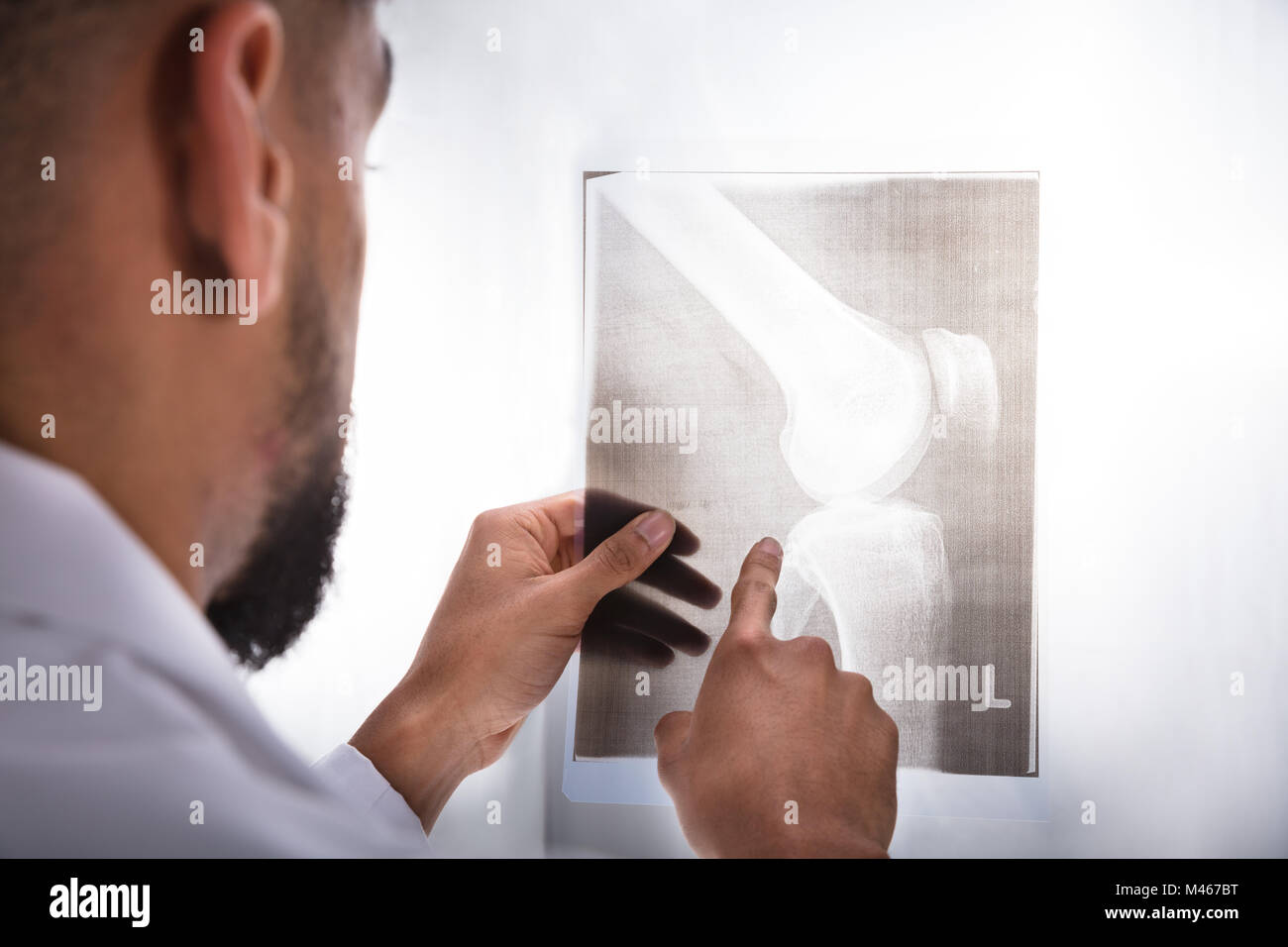 X ray image knee hi-res stock photography and images - Alamy