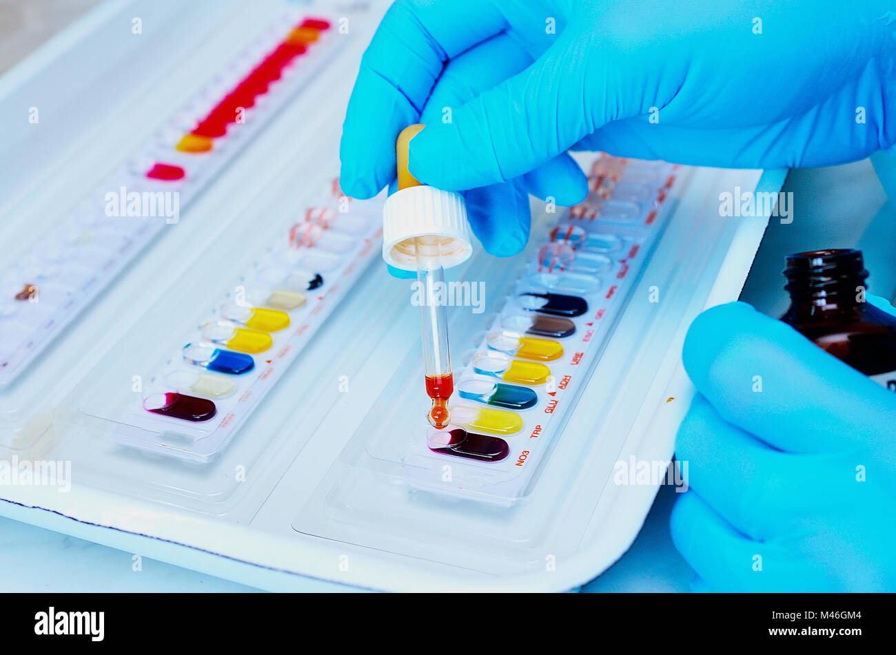 Microbiological laboratory. Mold and fungal cultures. Bacterial ...