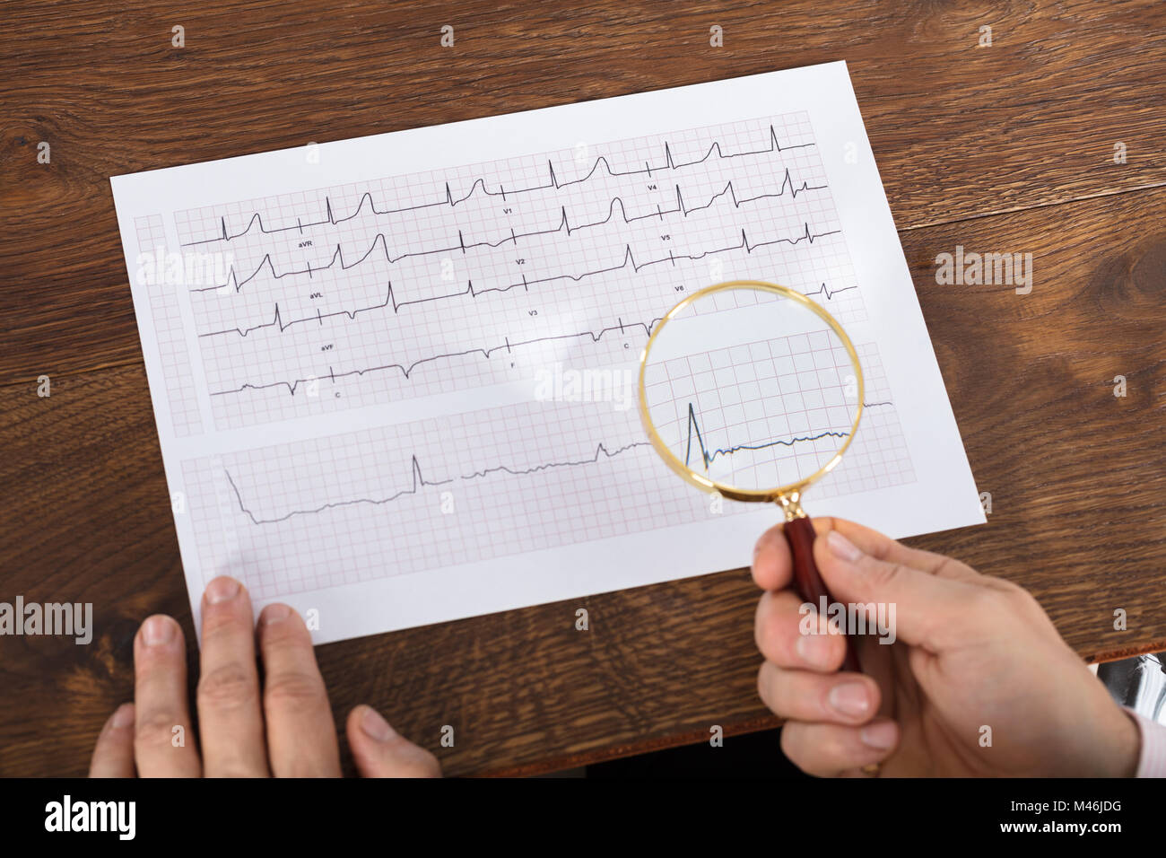 High Angle View Of Person Hand Analyzing Cardiogram Chart Using ...