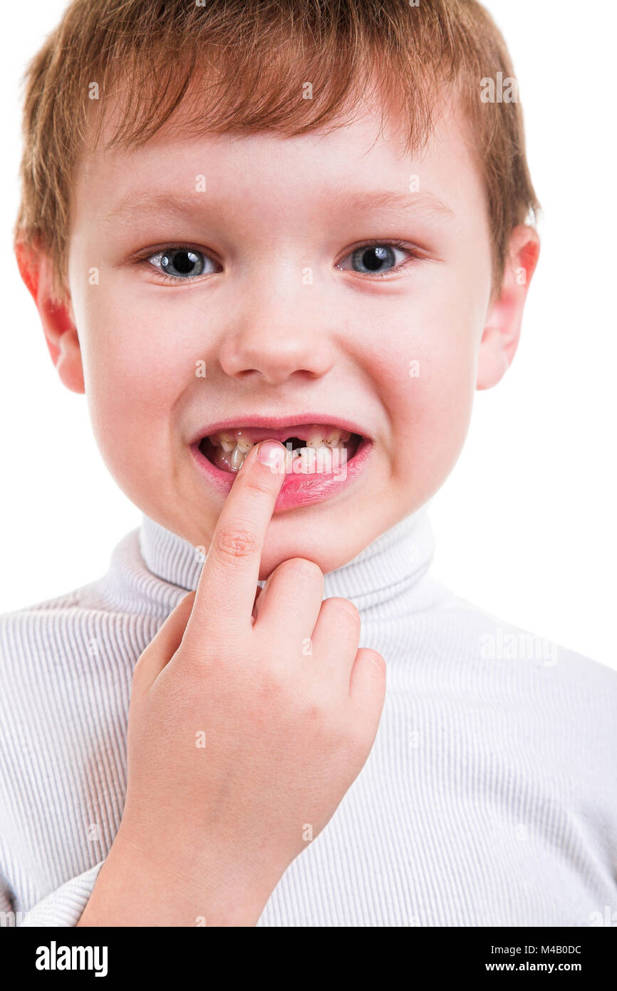 Smile with missing teeth hi-res stock photography and images - Alamy