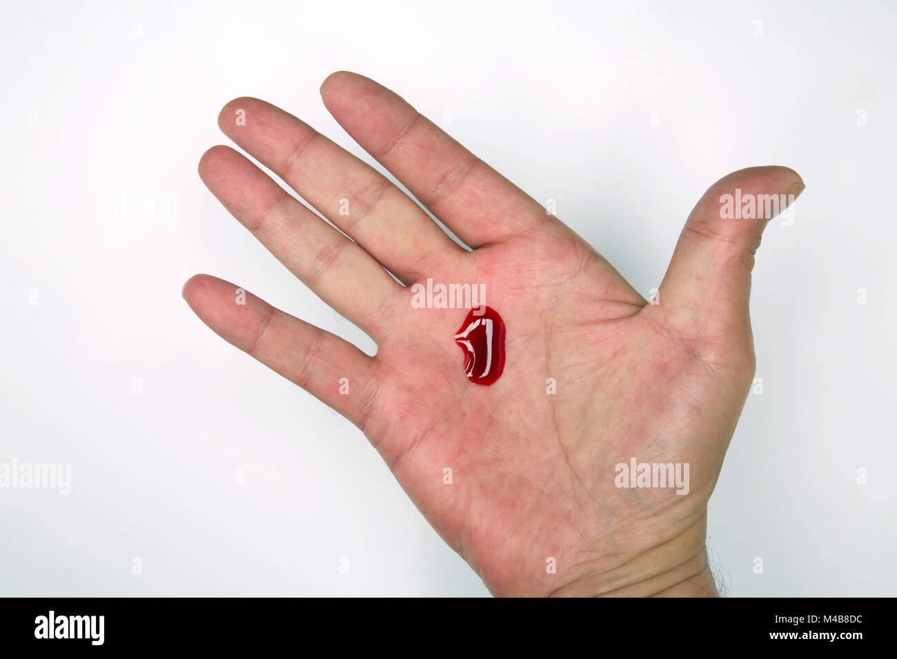 Blood on hand Stock Photo - Alamy