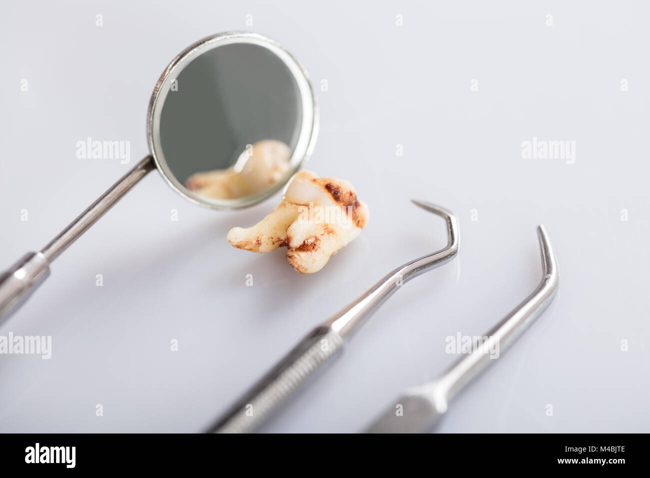 Dental caries decay hi-res stock photography and images - Alamy
