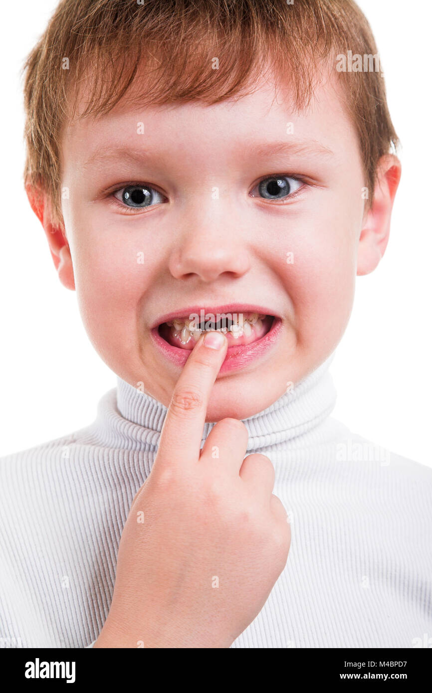 boy showing his missing milk teeth Stock Photo - Alamy boy showing his missing milk teeth Stock Photo - Alamy