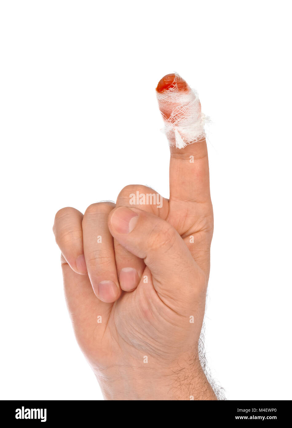 Hand with blood and bandage Stock Photo - Alamy