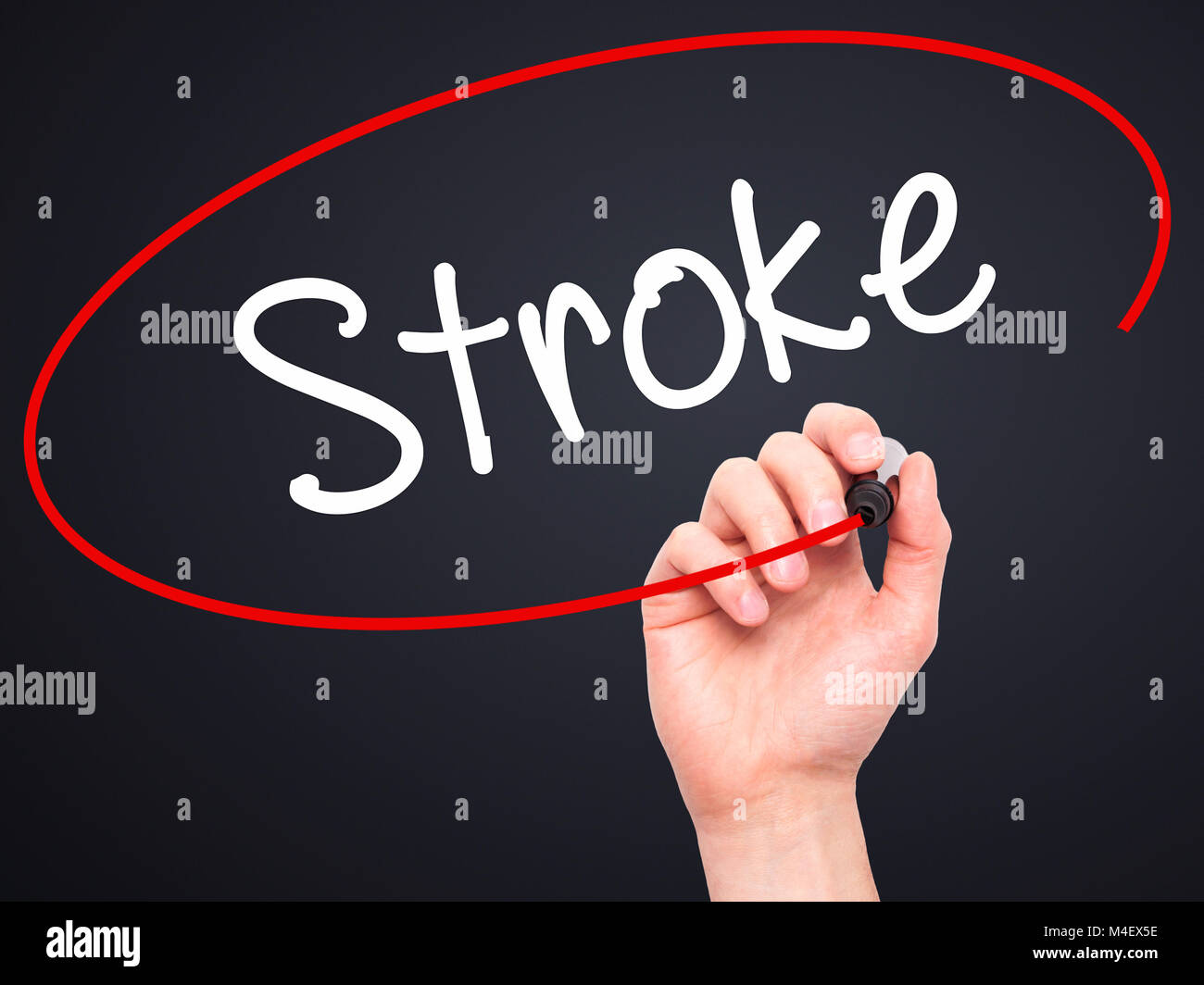 Stroke symptoms hi-res stock photography and images - Alamy