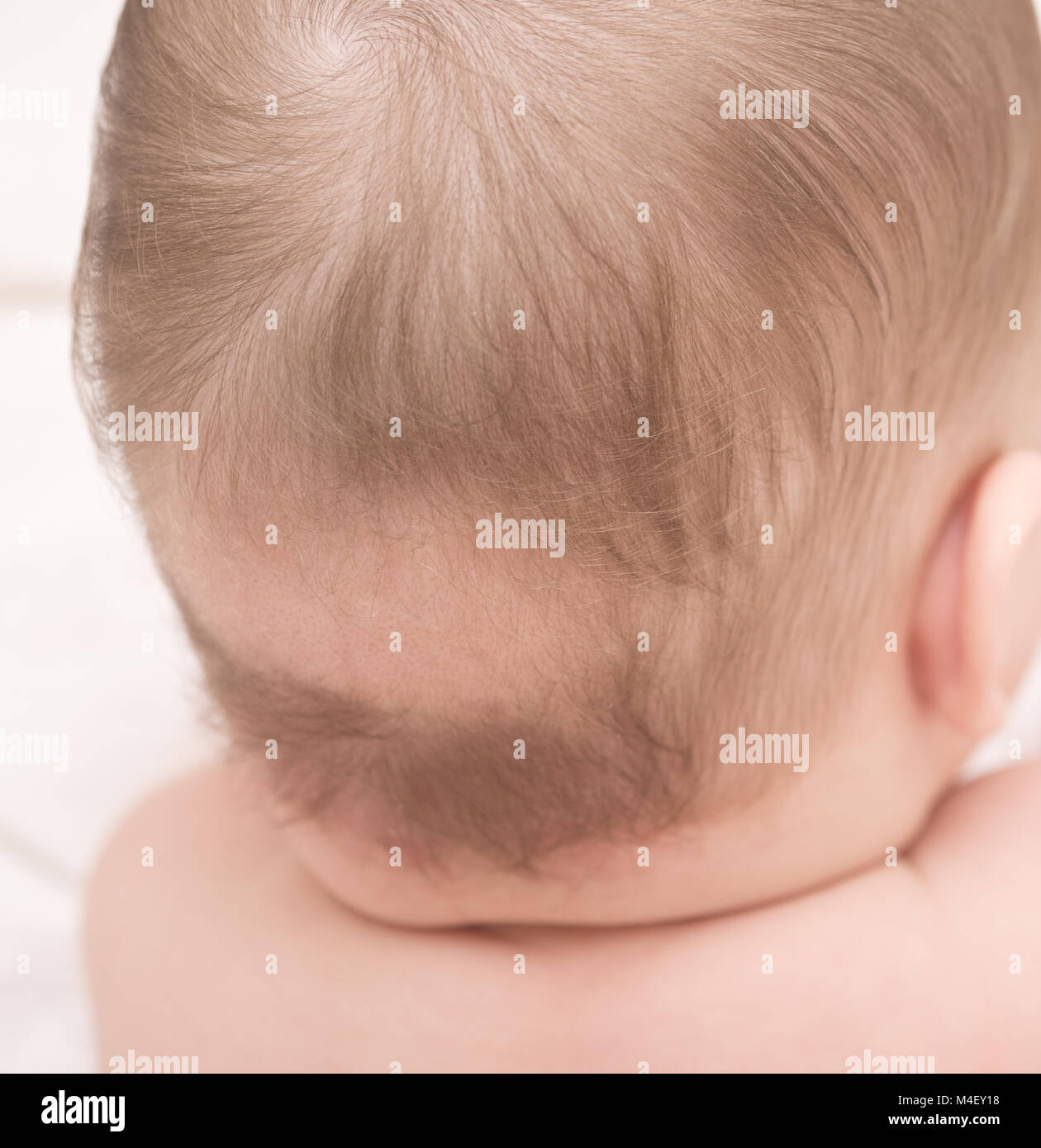Dark Patch Head High Resolution Stock Photography and Images - Alamy