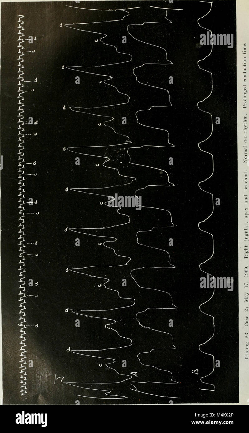 Archives of internal medicine (1908) (14593967870 Stock Photo - Alamy