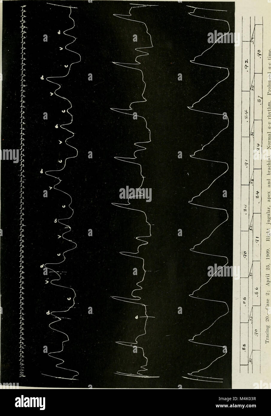 The Archives of Internal Medicine, first published in 1908, is a ...