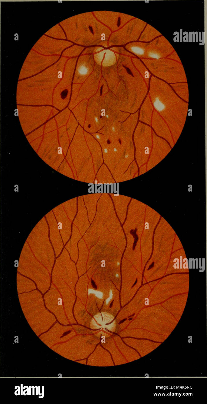 Ophthalmoscopic hi-res stock photography and images - Alamy
