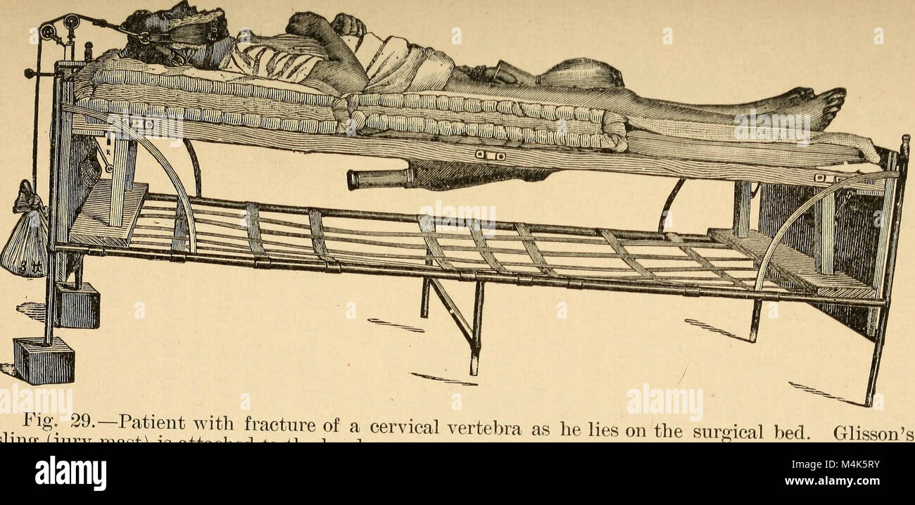This work from 1902 provides an atlas and summary of traumatic injuries ...