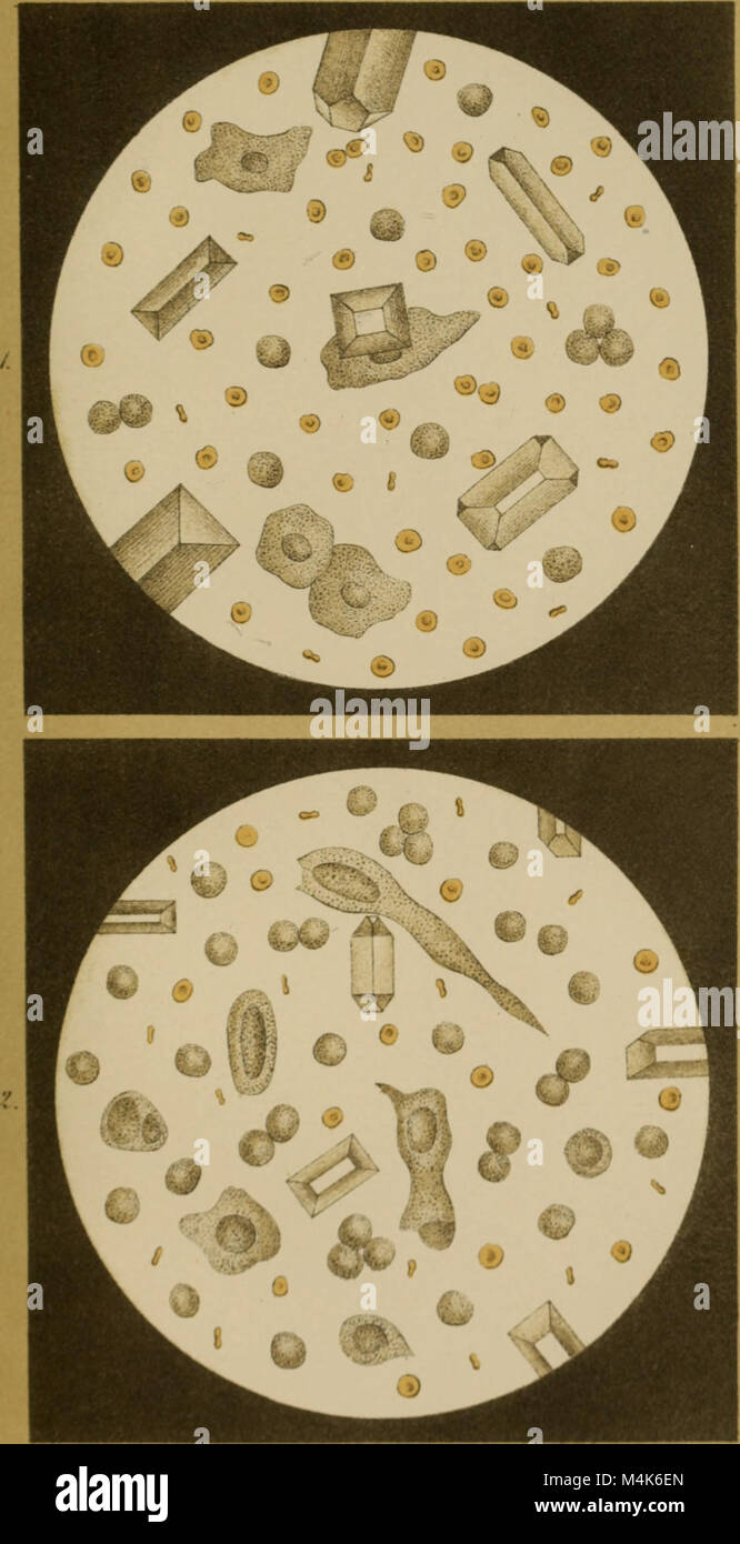 This 1871 Atlas of Physiological and Pathological Urinary Sediments ...